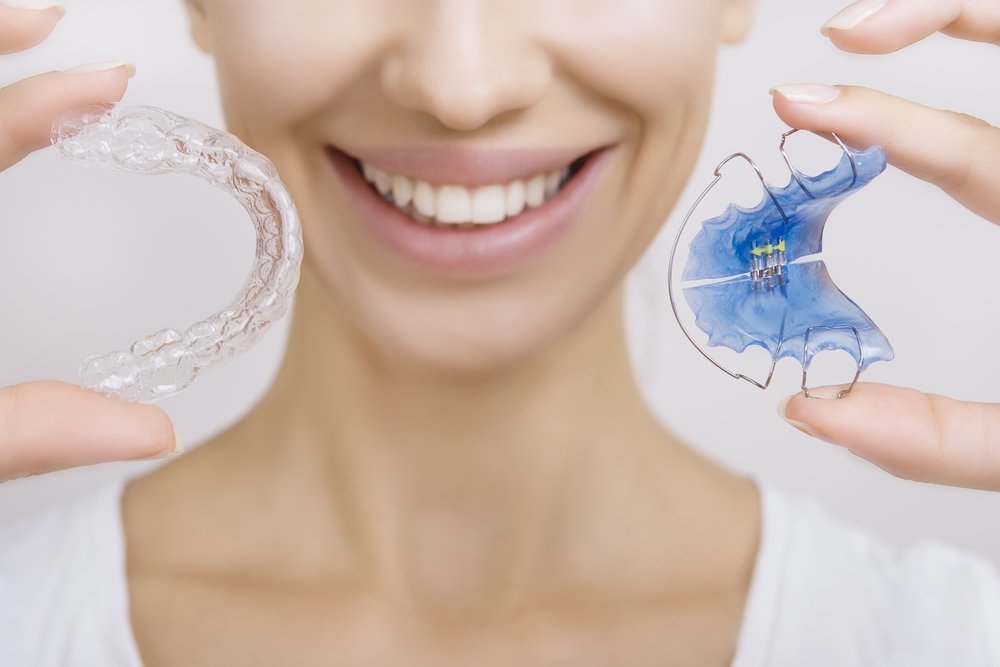 Which Retainers Is Good For You Permanent Or Removable - Transits Blog